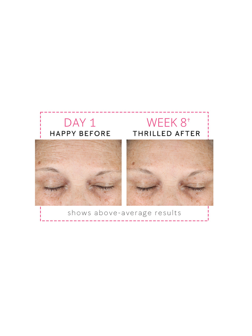 Clinical Solutions Dynamic Wrinkle Limiter | Mary Kay