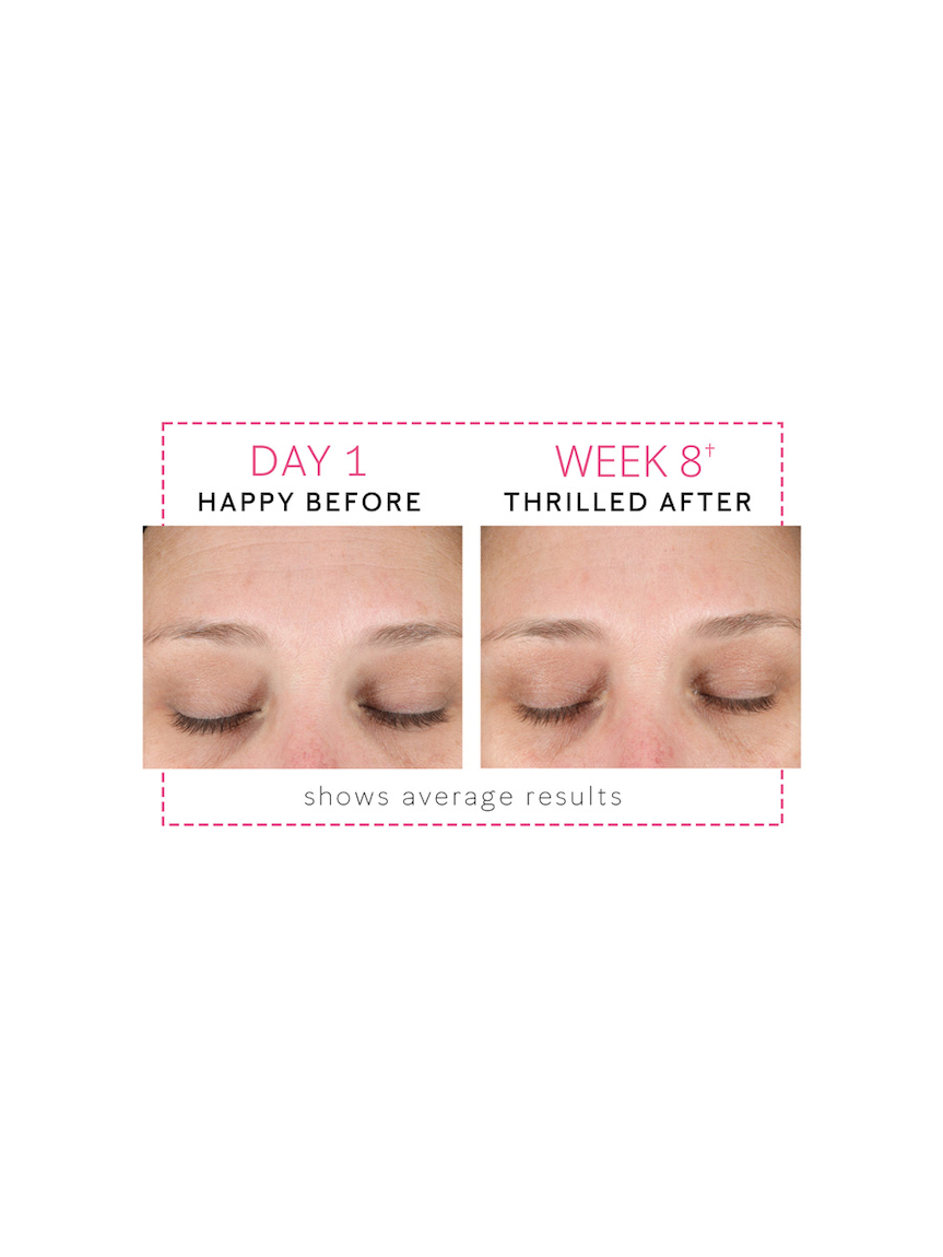 Clinical Solutions Dynamic Wrinkle Limiter | Mary Kay