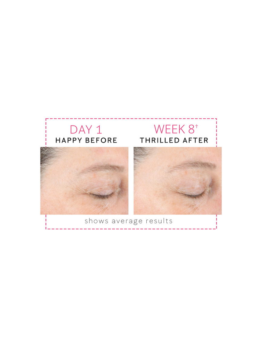 Clinical Solutions Dynamic Wrinkle Limiter | Mary Kay